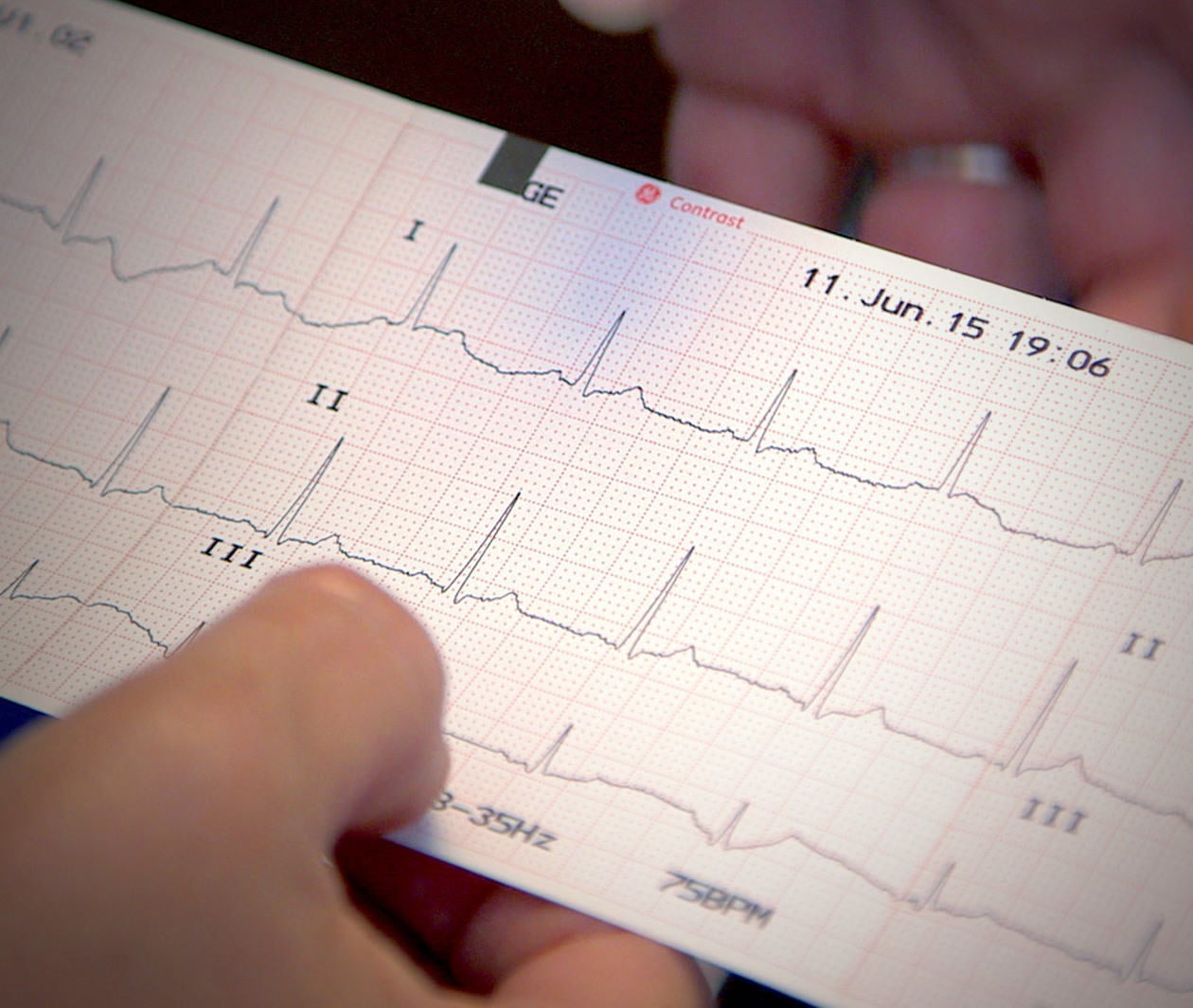 ECG Assessment - Online Course