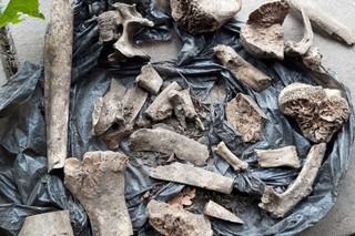 Introduction to Forensic Taphonomy