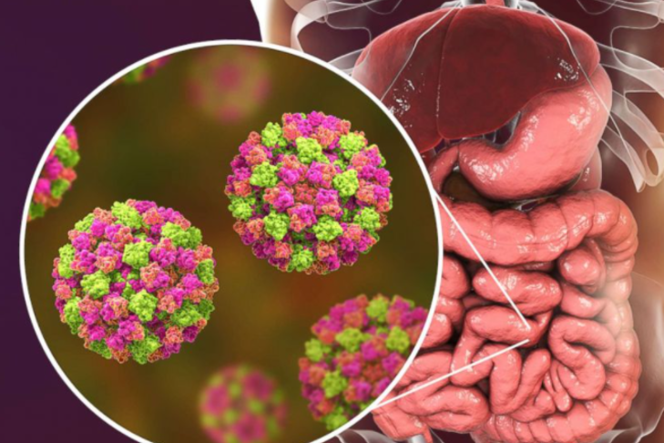 Causes of Food Poisoning