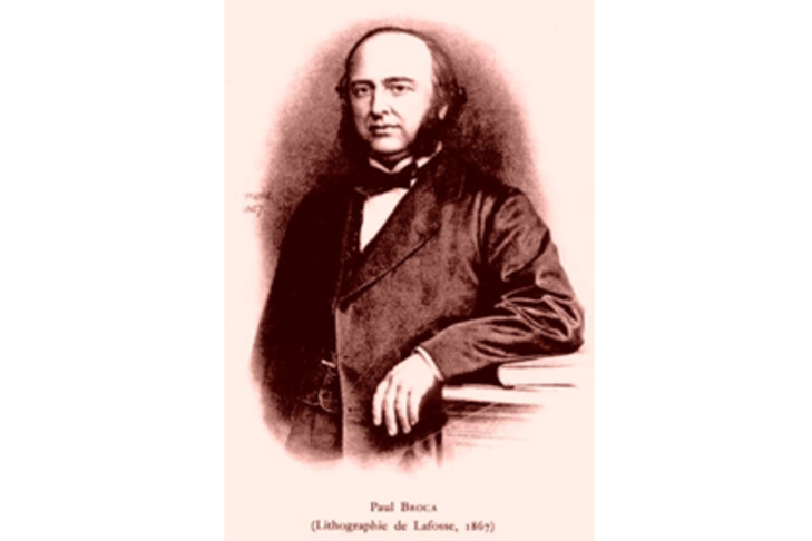 The researchers behind the classical language areas – Broca