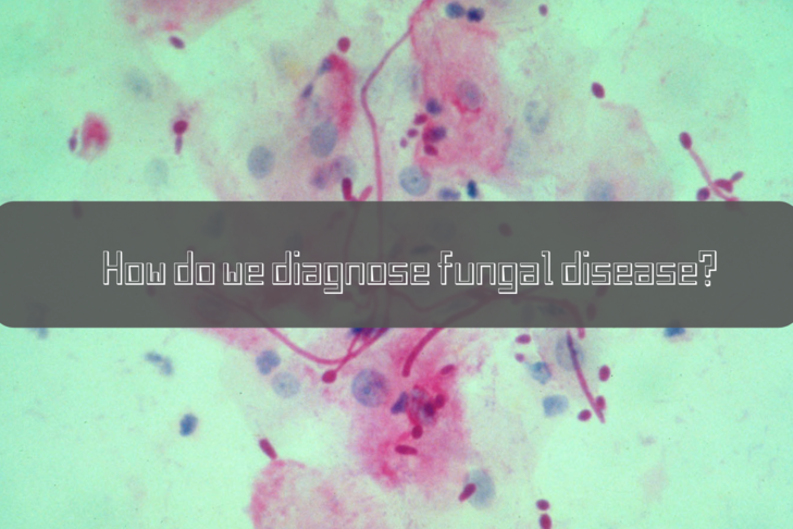 How do we diagnose fungal disease? – Part 1