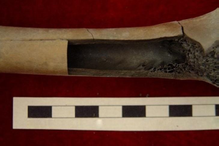 New Forensic Research on Burned Bone